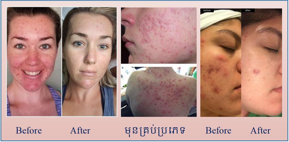 柬埔寨北京健康管理中心